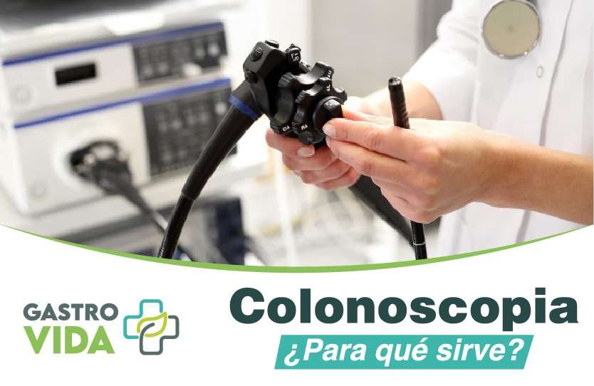 Colonoscopia ¿Para qué sirve? - Gastrovida