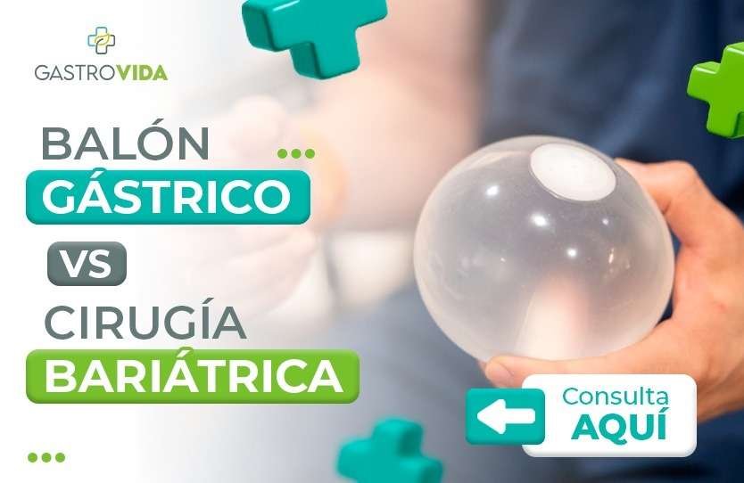 Balón Gástrico VS Cirugía Bariátrica: Ventajas y desventajas